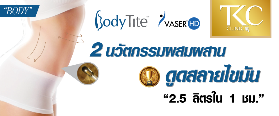 การดูดไขมันด้วย BodyTite มีความสะดวก เพียงใด ? จะเข้าใจได้เช่นไร | เปิด ...